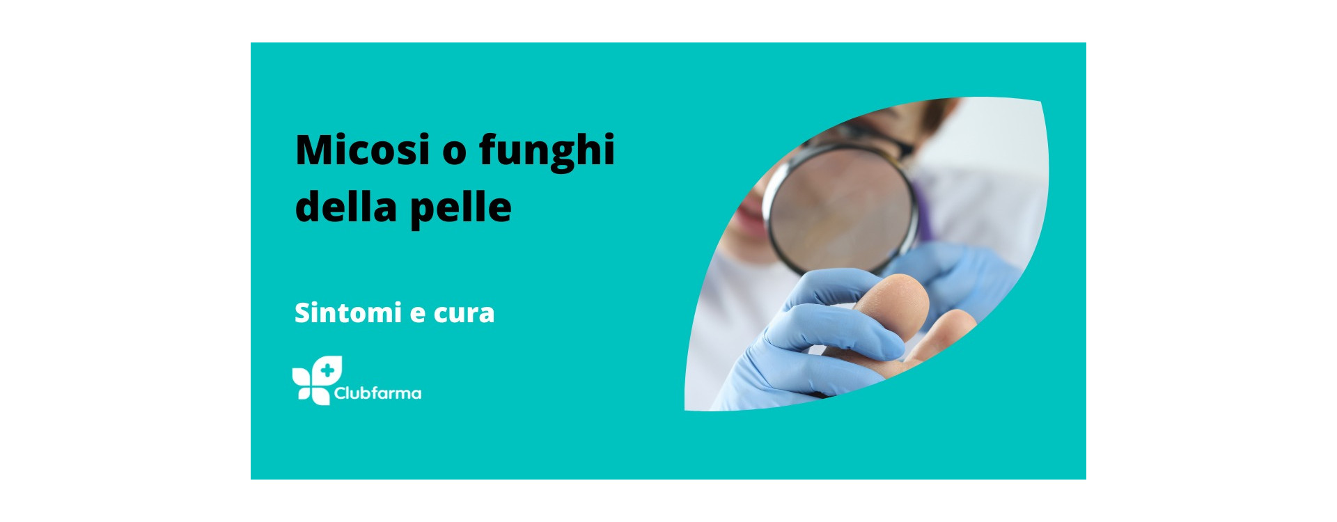 Micosi o funghi della pelle: sintomi e cura della malattia cutanea